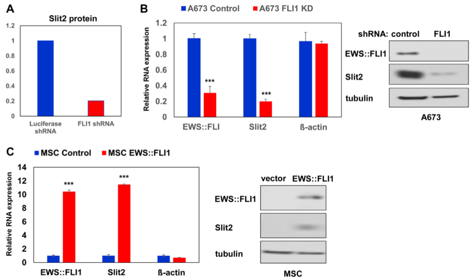 Genes & Cancer | Slit2 signaling stimulates Ewing sarcoma growth