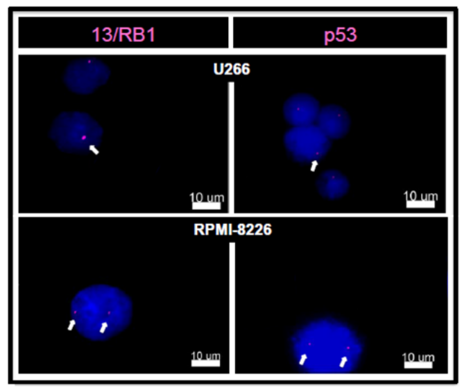 Genes & Cancer | Multiple myeloma cell lines and primary tumors ...